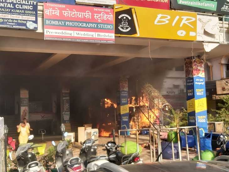 accident happened while cooking, it took 20 minutes for the fire ...