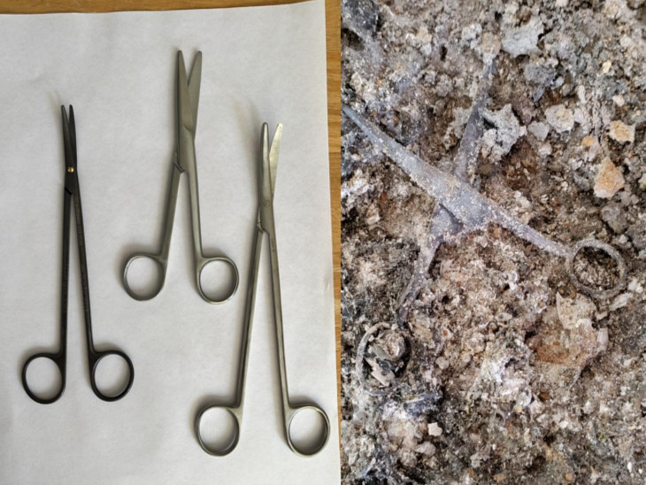 Hospital said- no facts of instrument being found in X-ray, family's ...