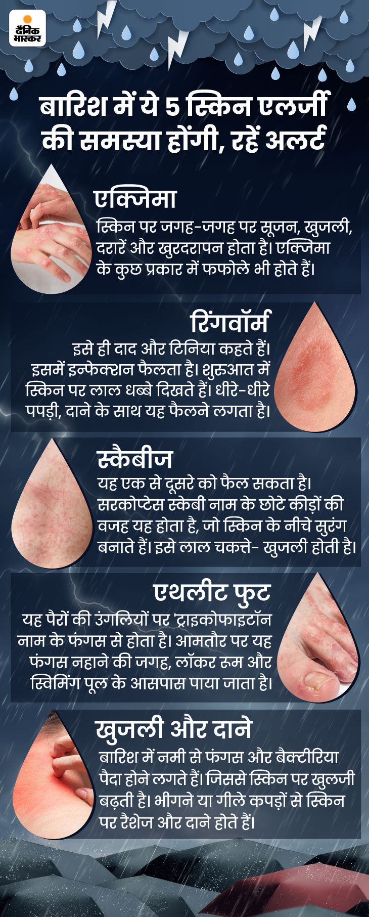Monsoon Skin Allergies Types; Rainy Season Common Skin Problems And ...