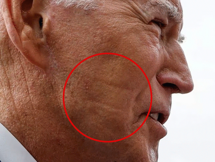 Joe Biden Health Update | Biden Using CPAP Machine For Sleep Apnea