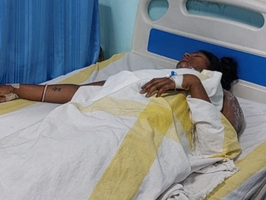 Husband pours hot water on wife...body scorched | पति ने खौलता हुआ पानी ...