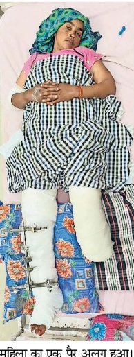 Woman crossing road hit by container, one leg amputated | सड़क क्रॉस कर ...