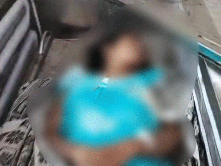 18 day old infant girl burnt with hot iron rods