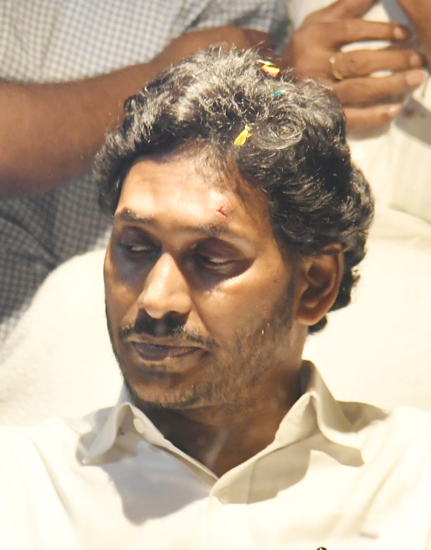 Andhra Pradesh CM Jagan Mohan Reddy Attack Photos; Stone Pelting ...