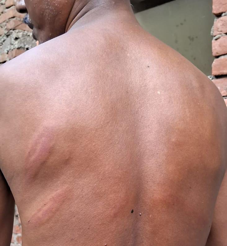 Pump operator beaten up due to water shortage | पानी की किल्लत को ले ...