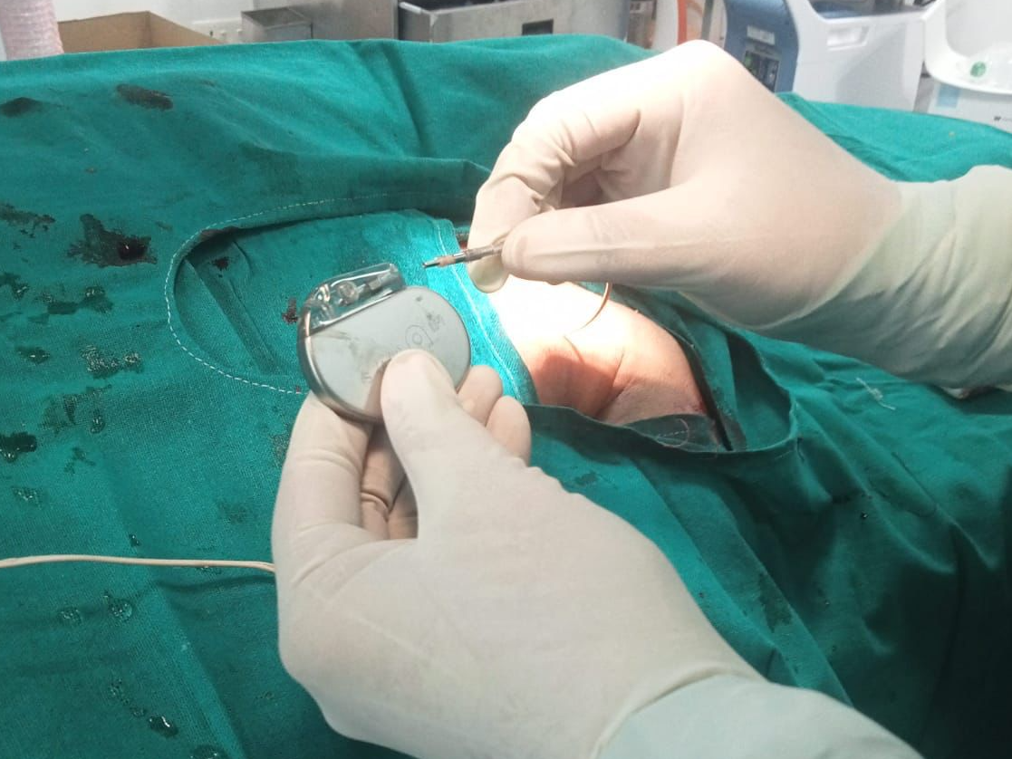 The first pacemaker was installed in SN Medical College | एसएन मेडिकल ...