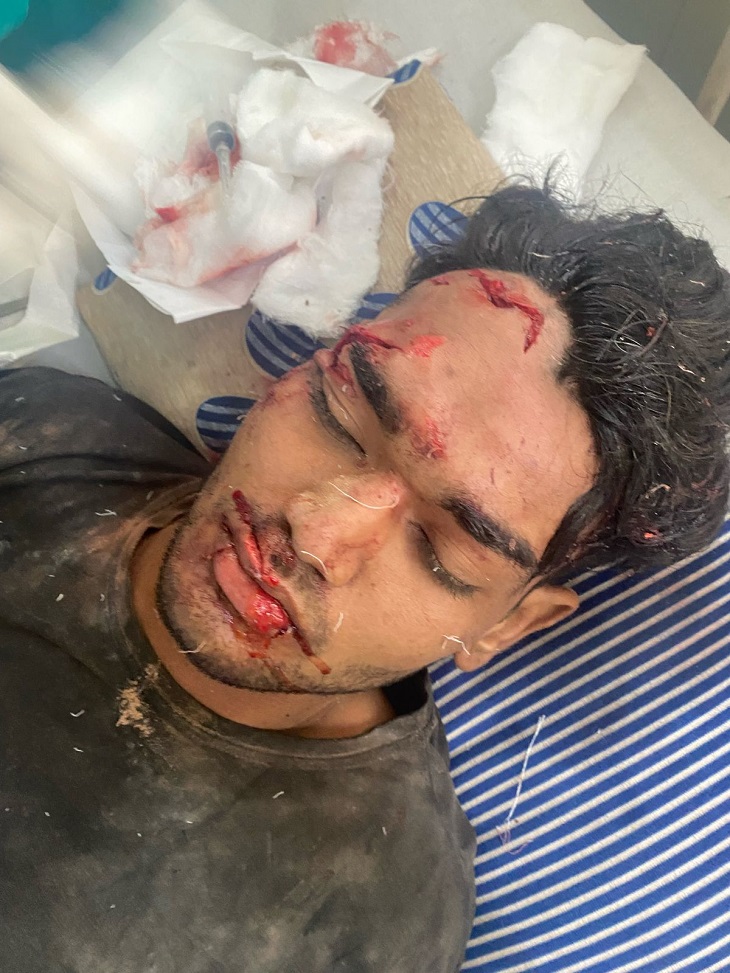 Part of the ceiling collapsed in the ward of SMS Hospital | SMS ...