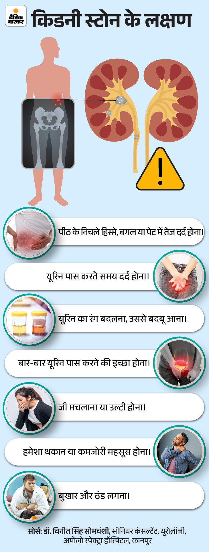 Summer Kidney Stone Problem; Signs And Symptoms Explained | किडनी स्टोन ...