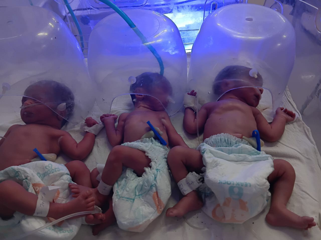 The woman gave birth to three children at once