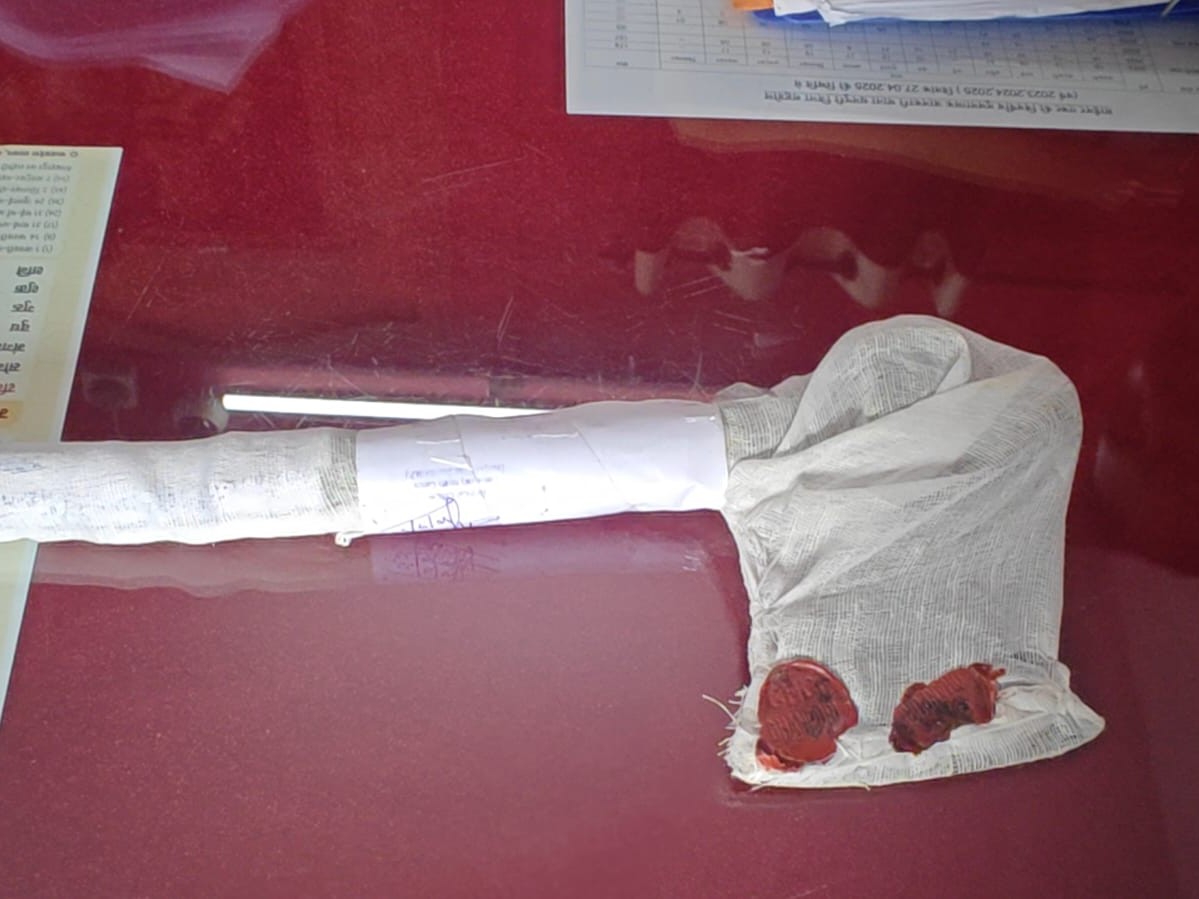 When someone passed in front of the house, his ear was chopped off with ...