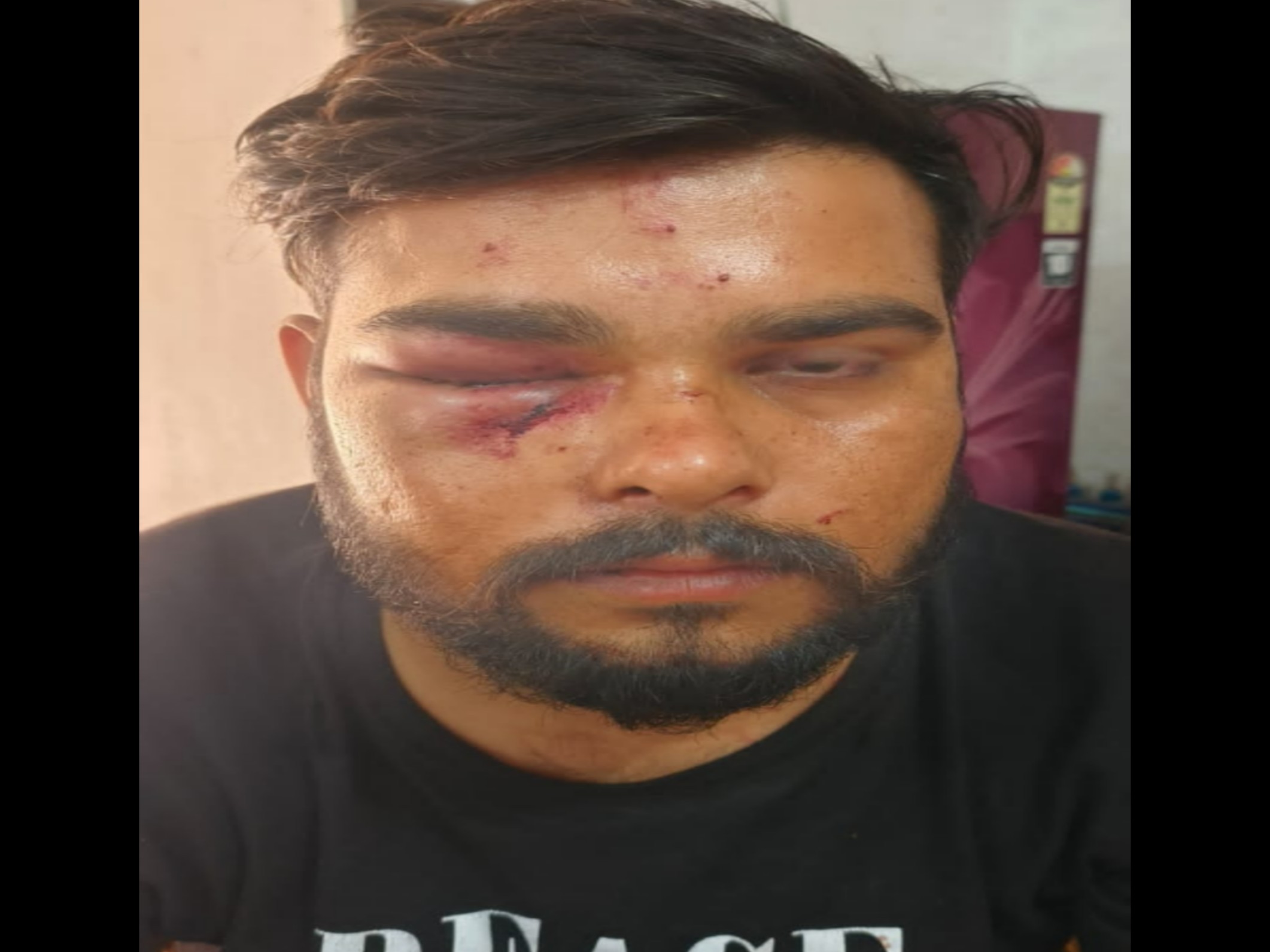 Canteen operator beaten up in Fatehpur Sikri | फतेहपुर सीकरी में कैंटीन ...