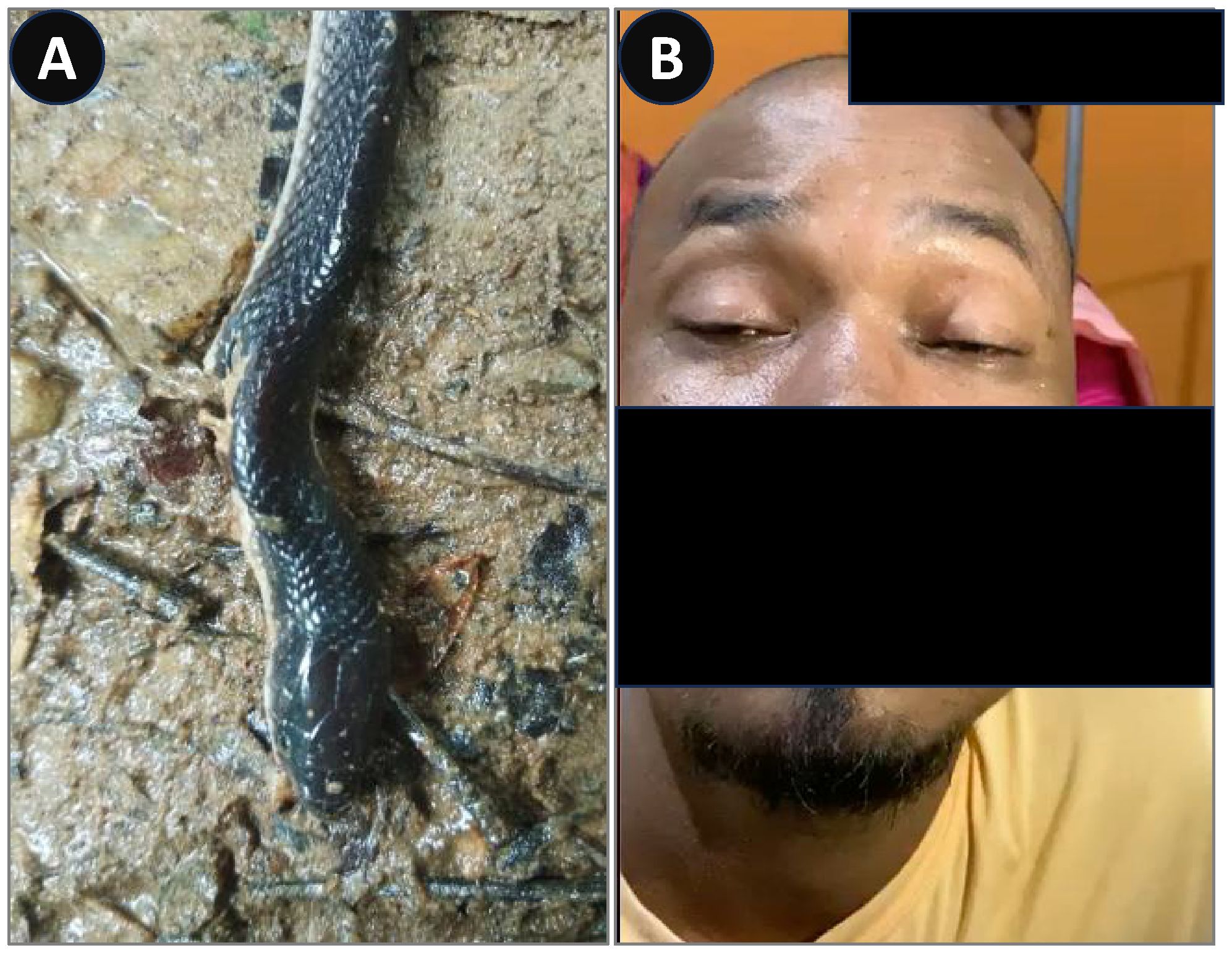 18-year-old bitten by dead snake in Morena: Experts say reflex action ...
