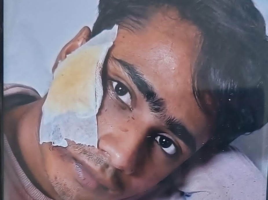 Bike collides with divider in Greater Noida | ग्रेटर नोएडा में डिवाइडर से टकराई बाइक: गलगोटिया ...