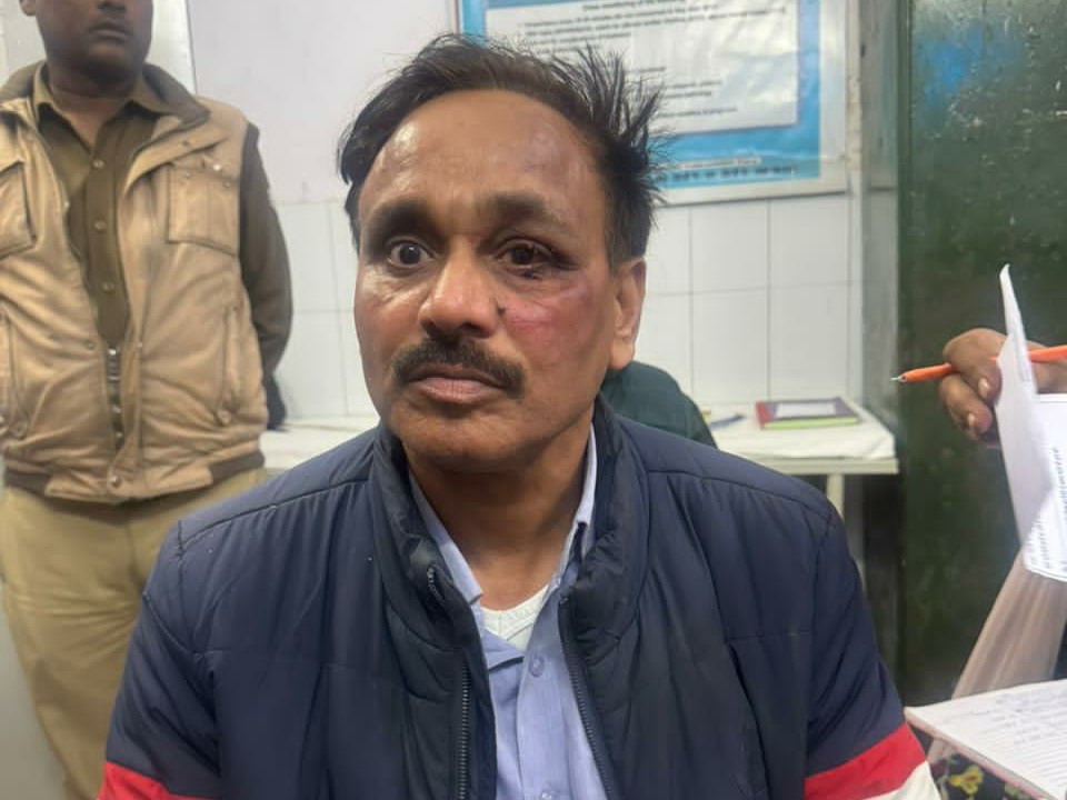 Gunmen attack ADO of Agra's Akola