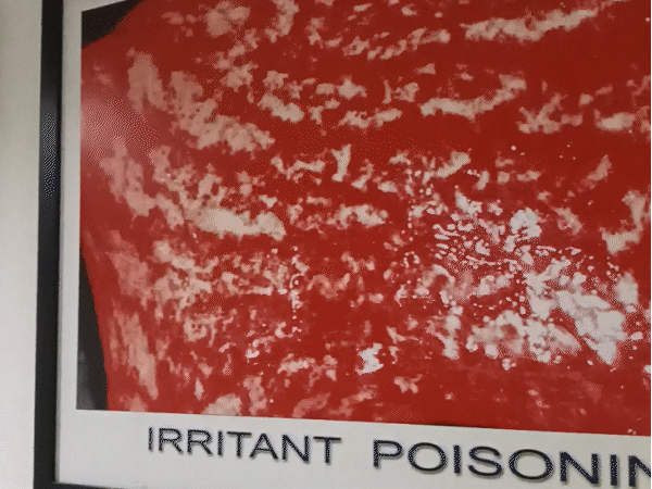 Every second victim of poisoning is a child under 10 years of age
