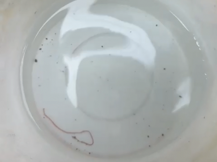 Indore Water Contamination Outbreak Crisis LIVE Updates; Bhagirathpura ...