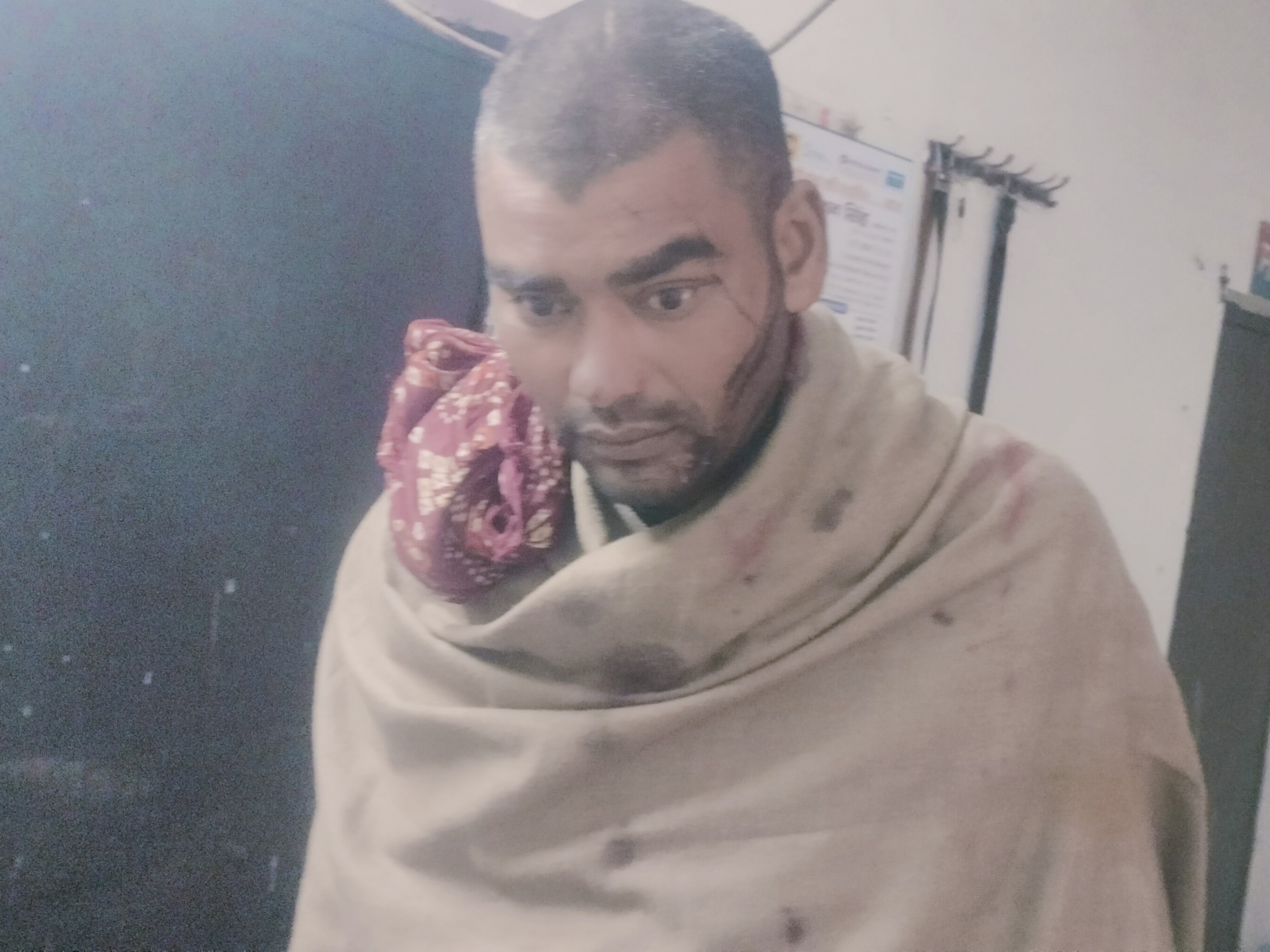 Mathura: Brother Smashes Head For Stopping Cow Milk Extraction