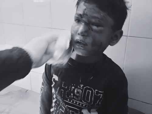 Pithoragarh Leopard Attack: Fathers Bravery Saves Child | Deep Claw ...