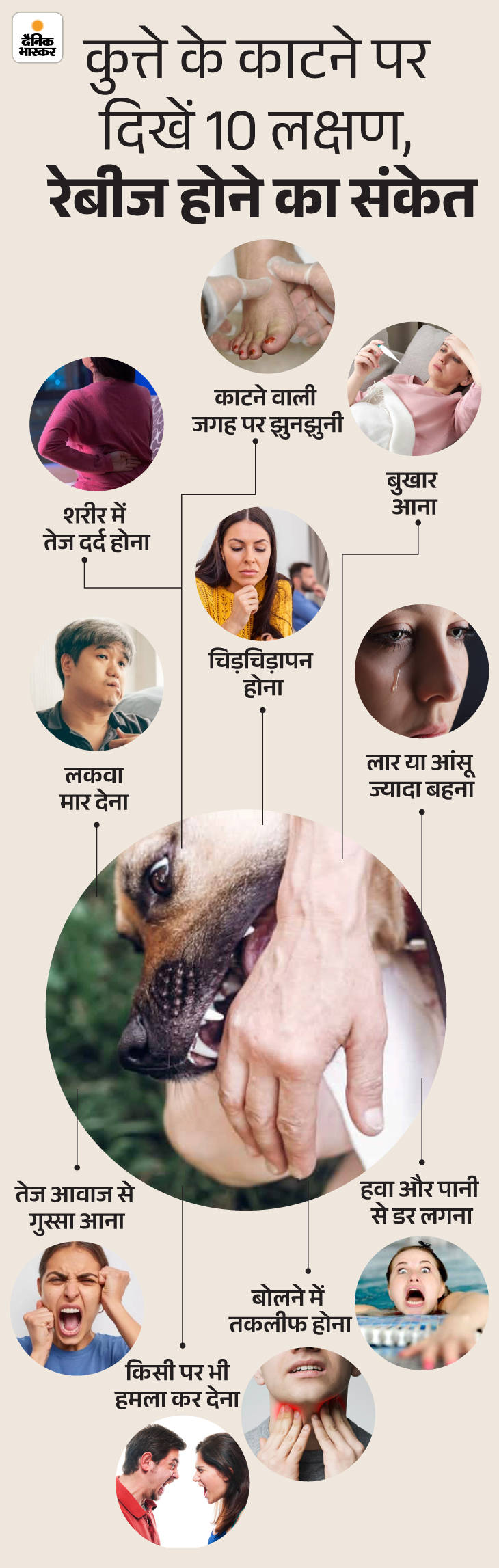 Agra Child Dies of Rabies After Vaccine | Dog Bite