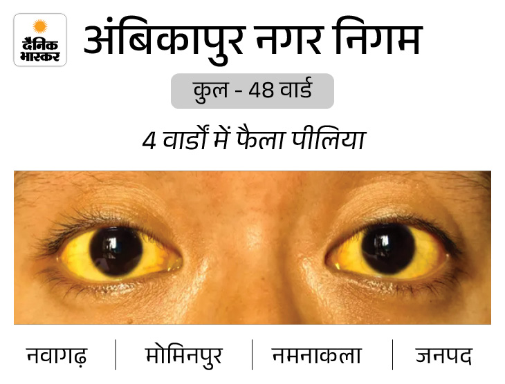 Ambikapur Jaundice Outbreak: 2 Deaths, 60+ Cases; Singhdeo Blames ...