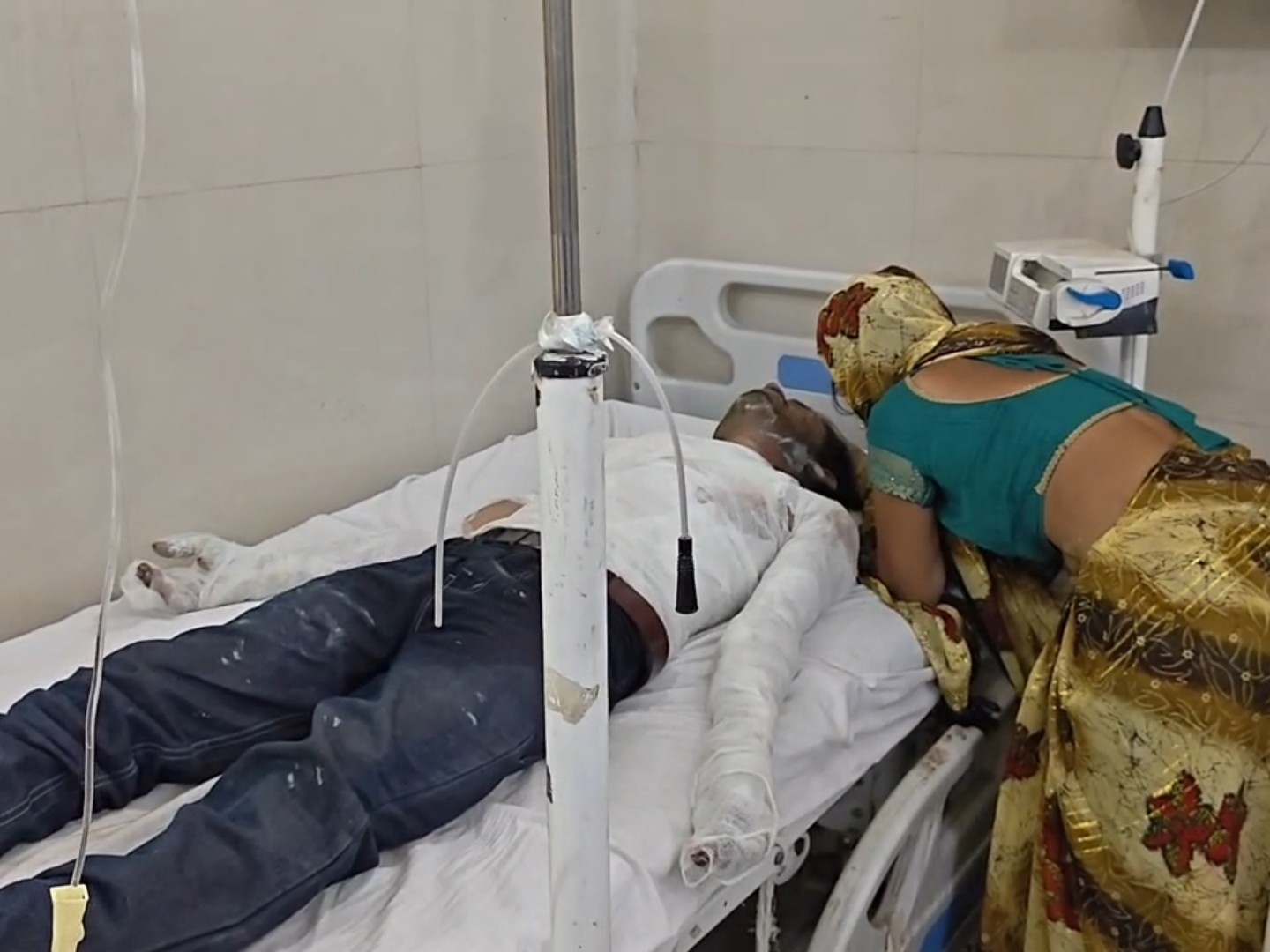 Firozabad Accident: Laborer Seriously Burned in Lamp Blast During Chudi ...