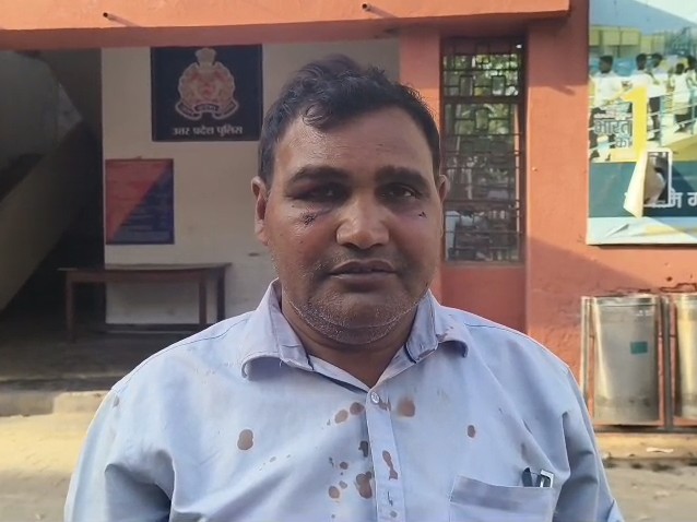 Mariyahu Gram Pradhan & 4 Others FIR | Victim Attacked After Suspension