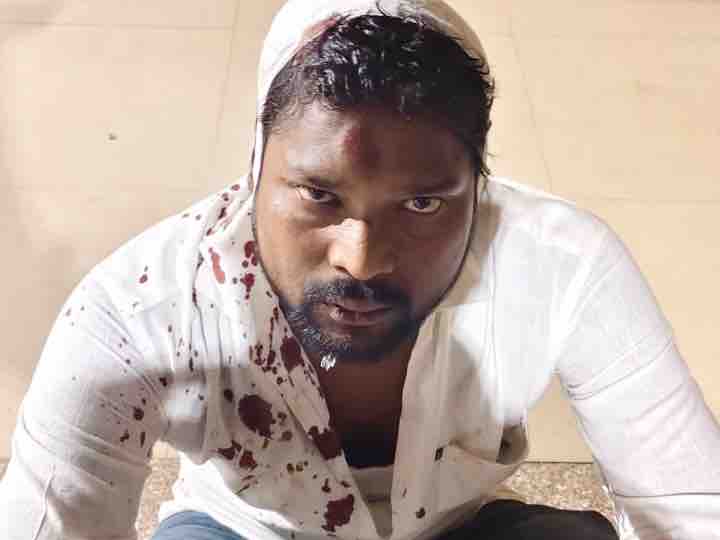 Barhalganj Coffee Shop Attack: Shopkeeper Injured, 20 Booked