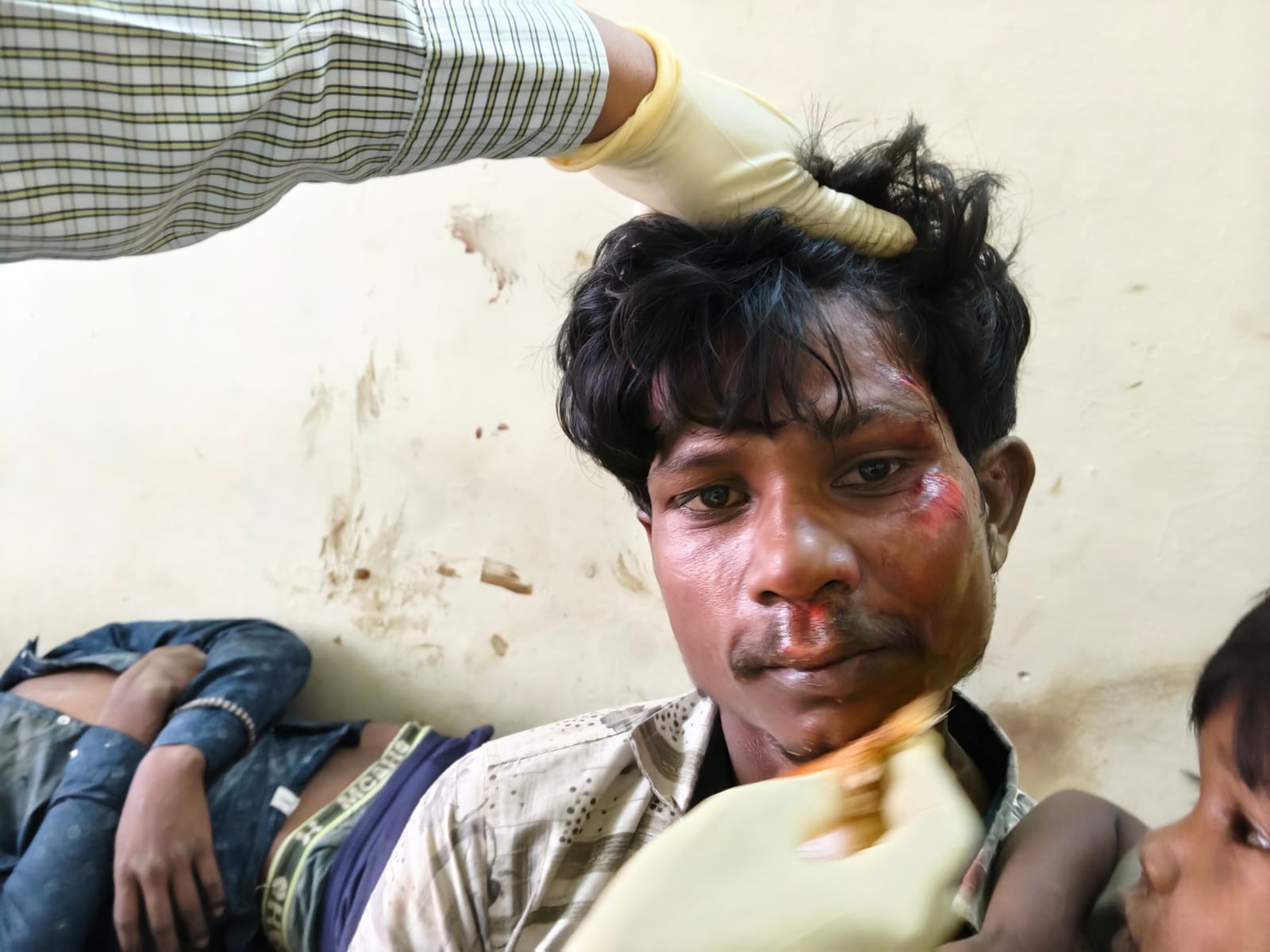 Gandhi Nagar Accident | Bike Pit Fall Five Injured