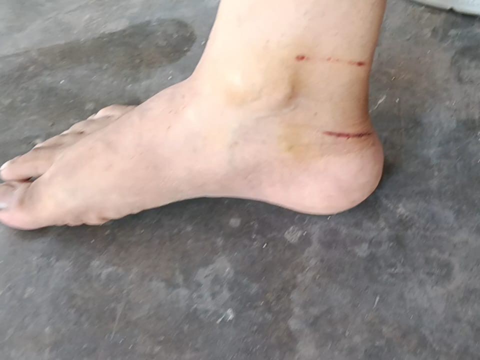 Modipuram Monkey Attack | Face-1 Colony Negligence Allegations