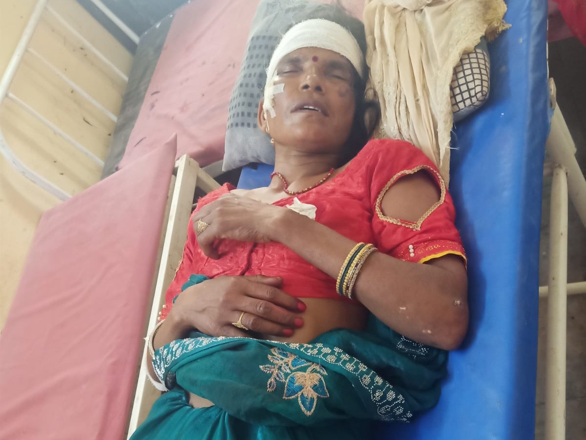 Achhalda Woman Falls Stairs | Critical, Referred Higher Center