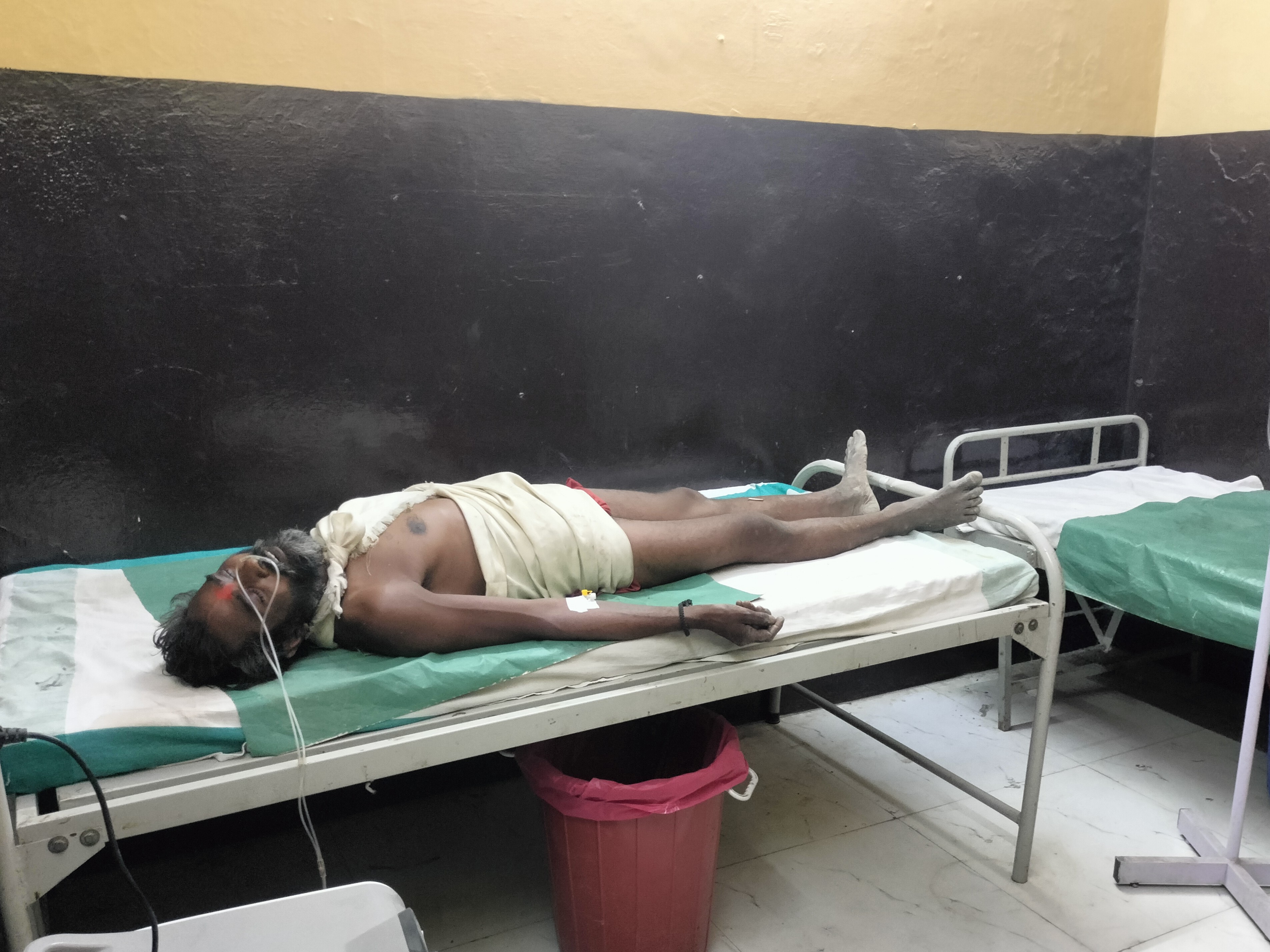 Ayodhya Sadhu Unconscious | Milkypur Market Sadhu Critical, Referred To ...
