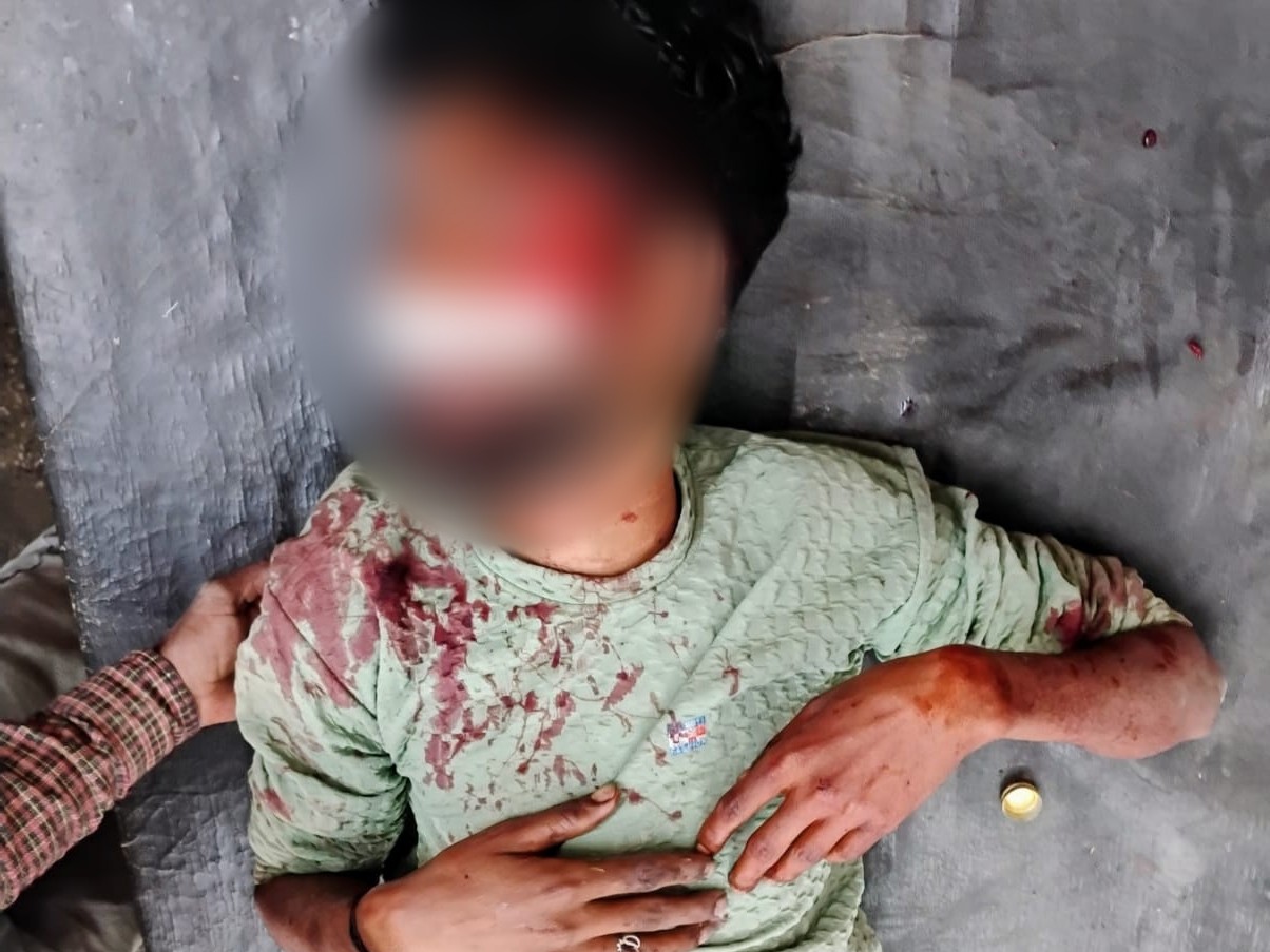 Damor Mod Accident: Youth Injured in Bike Collision