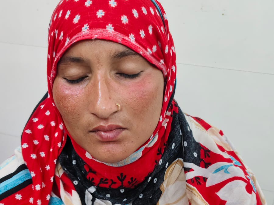 Swar Clash | CCTV Dispute Leaves 8 Injured