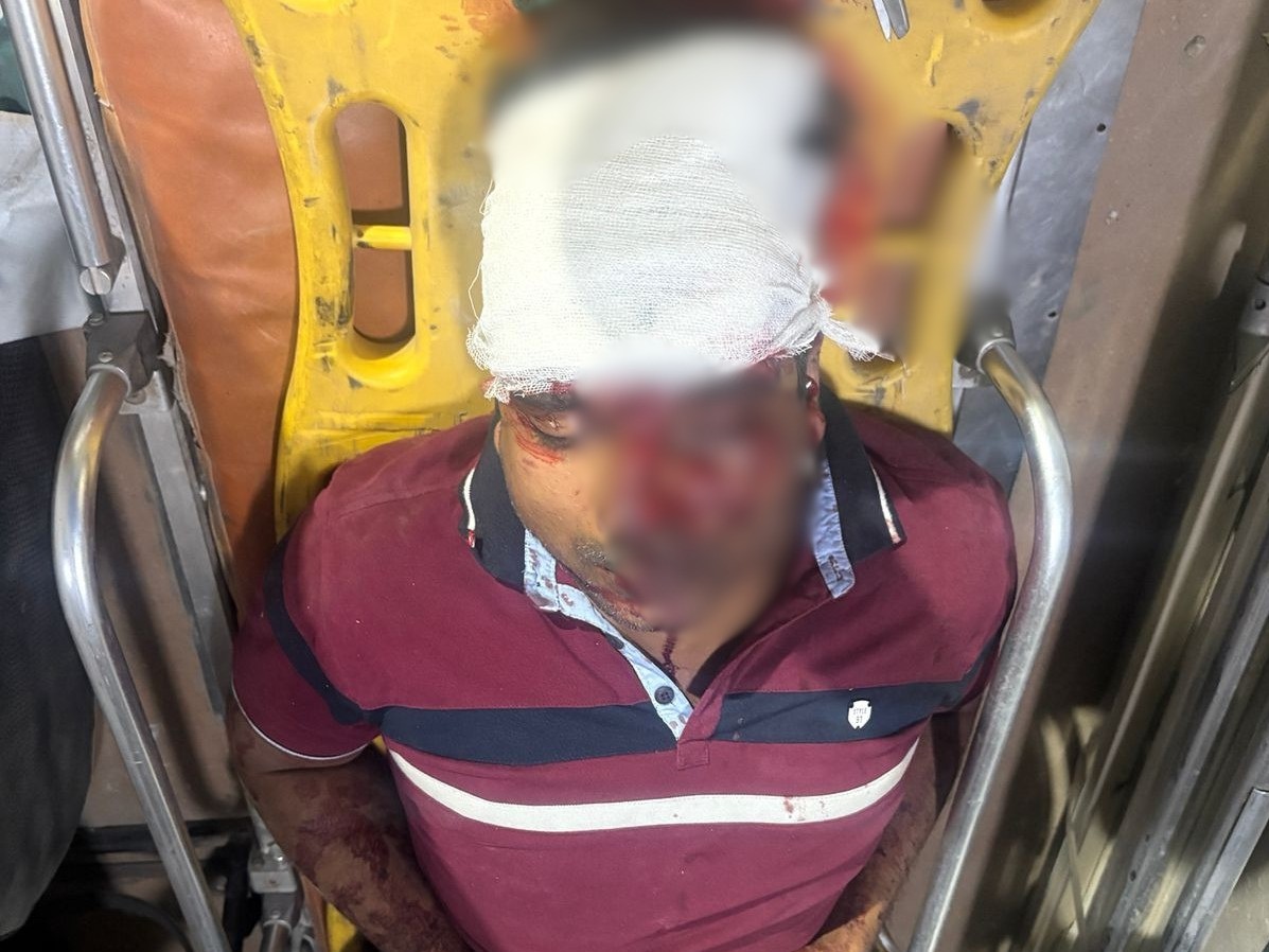 Mirzapur Train Accident: Youth Critical After Falling Off Train