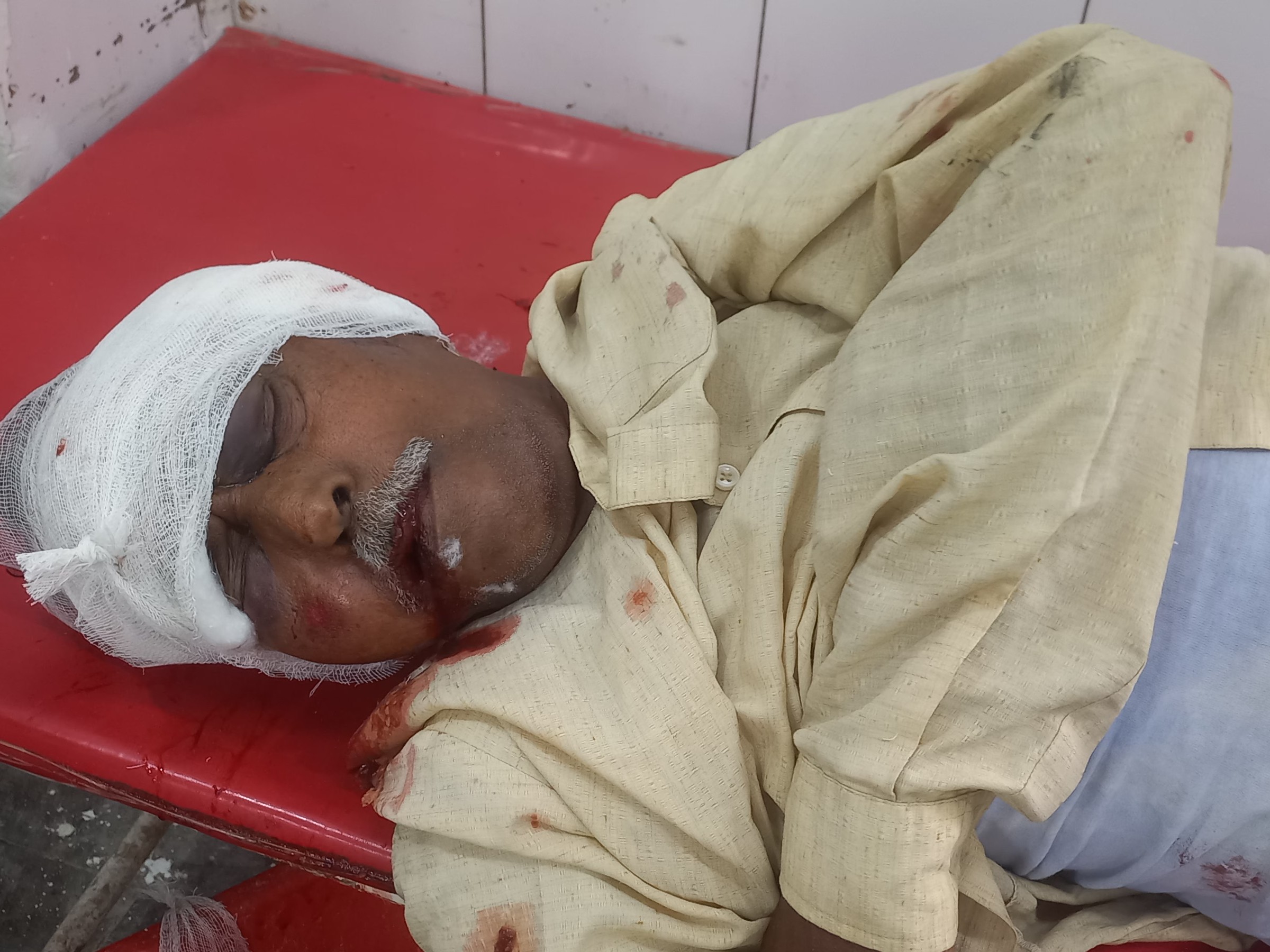 Shahabad Tanda Village Accident | Five Injured in Bike Collision