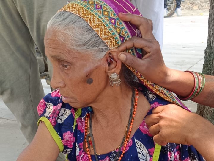 Bahraich Wild Animal Attack | Elderly Woman Injured; Forest Dept ...