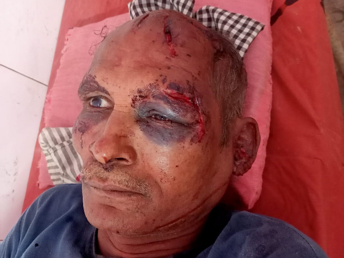 Farrukhabad Mute Man Assaulted | Critical Condition, Lohia Hospital Refer