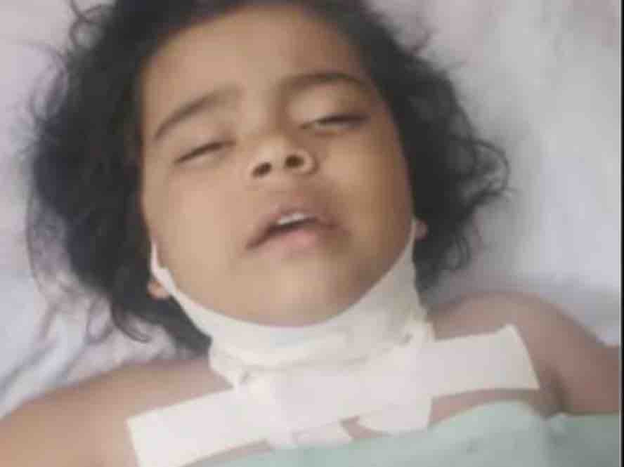 Rampur Chinese Manjha Danger | Four Injured Despite Ban