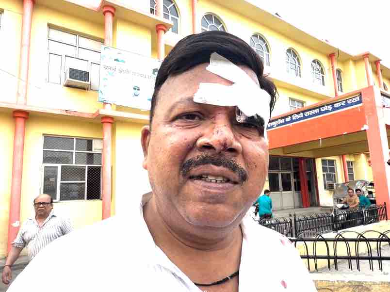 Rampur Chinese Manjha Danger | Four Injured Despite Ban