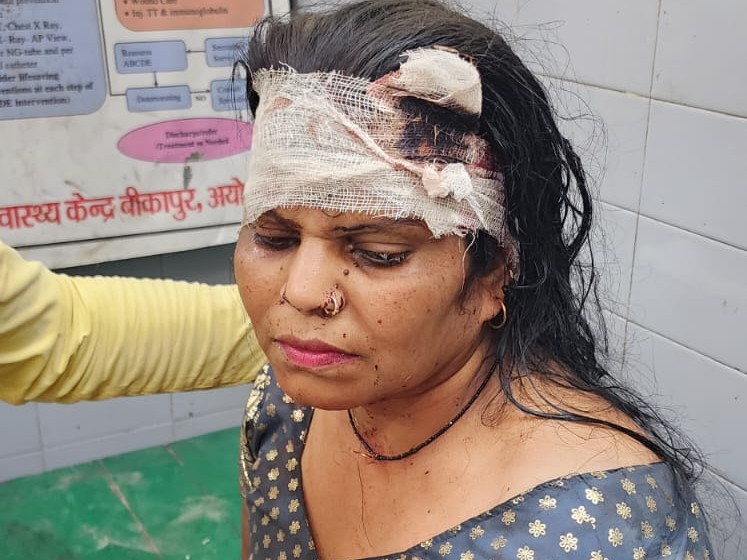 Bike Accident Tiwaripur Mod | Woman Serious Head Injury; Hospital Refer