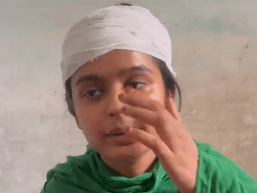 Kanpur Attack: Four Sisters Assault Woman With Iron Rod Over Cat