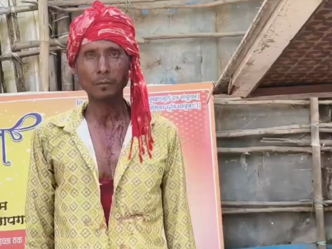 Patti Police FIR Registered | Uncle Accuses Nephew Assault