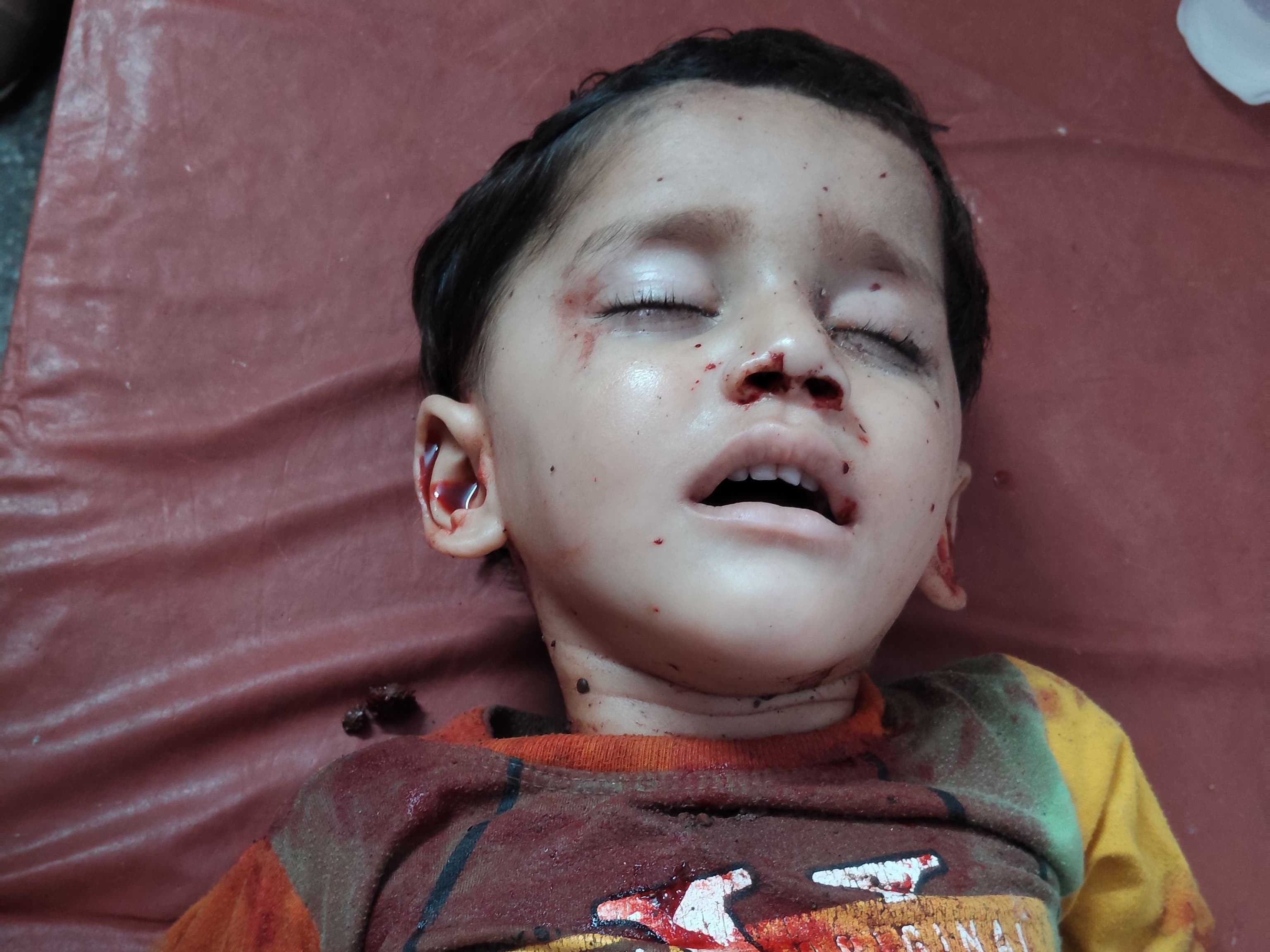 Farrukhabad Children Injured | Brick Structure Collapse