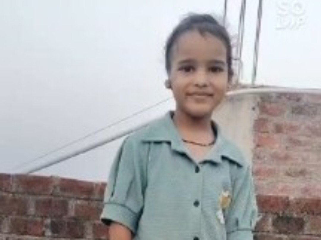 Dewas Girl Microtia Surgery | Amaltas Hospital Rib Bone Ear Reconstruction