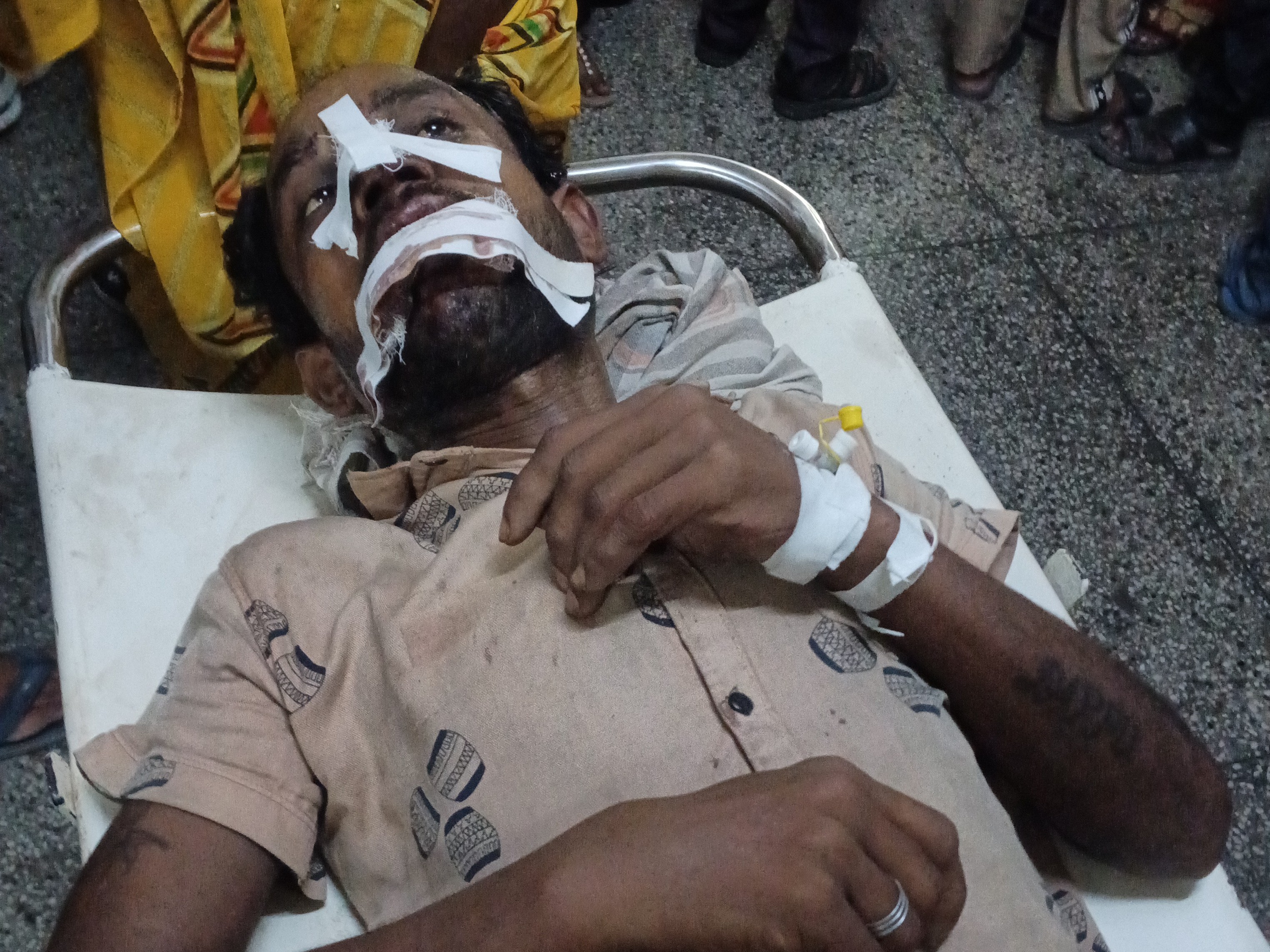 Kushinagar Youth Falls From Roof | Injured, Hospital Treatment