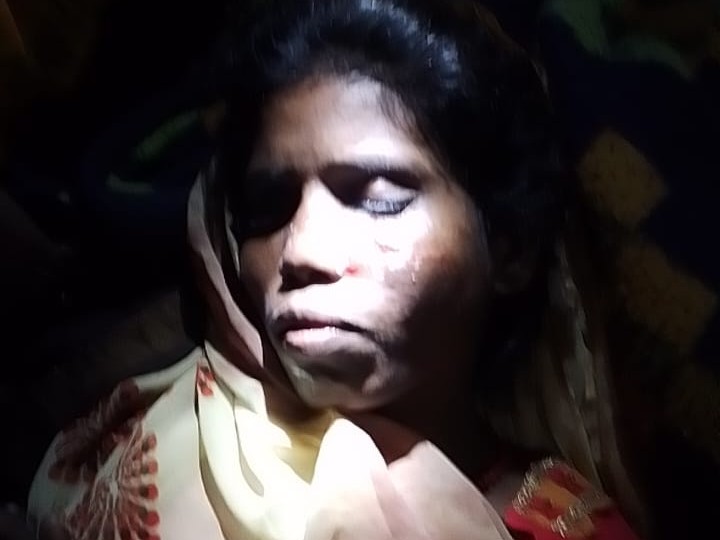 Pindra Rabies Injection Hospital | Woman Bitten by Dog