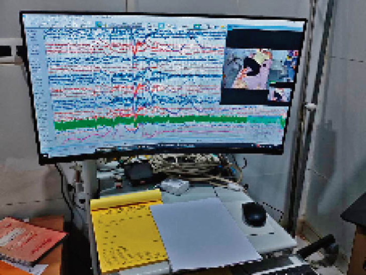 SMS has installed a 90 lakh hi-tech ECoG machine, which will read the ...