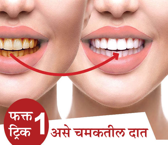 One Simple Tip For White And Shiny Teeth, Tip For Shiny Teeth | 5 ...