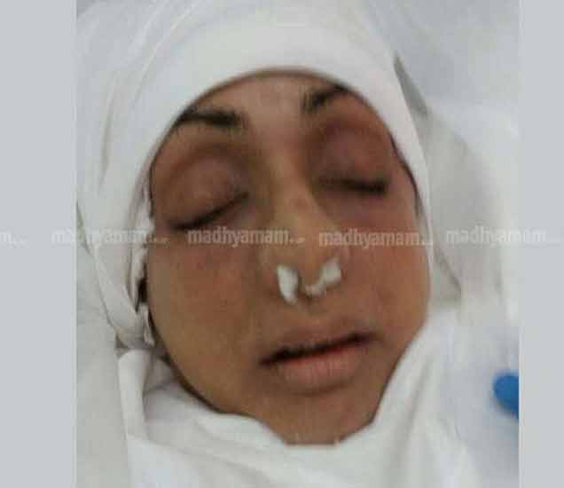 Sridevi Dead Body Photos | WhatsApp वर व्हायरल होतोय श्रीदेवीच्या डेड ...