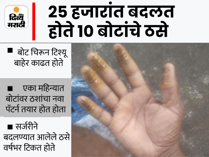 Fingerprint surgery gang busted in Telangana, latest news and update ...